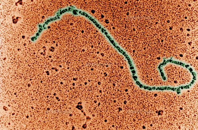 Single strand of DNA[01808012757]の写真素材・イラスト素材｜アマナイメージズ