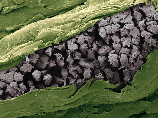 Crown Rust On Oats[01808024193]の写真素材・イラスト素材｜アマナイメージズ