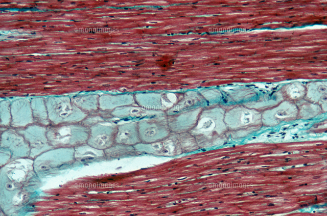 LM of Cardiac Muscle[01808031102]の写真素材・イラスト素材｜アマナイメージズ