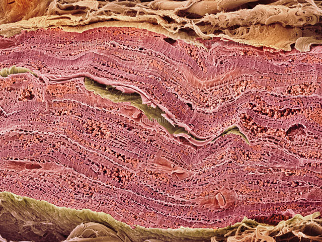 Cardiac muscle，SEM[01809021558]の写真素材・イラスト素材｜アマナイメージズ