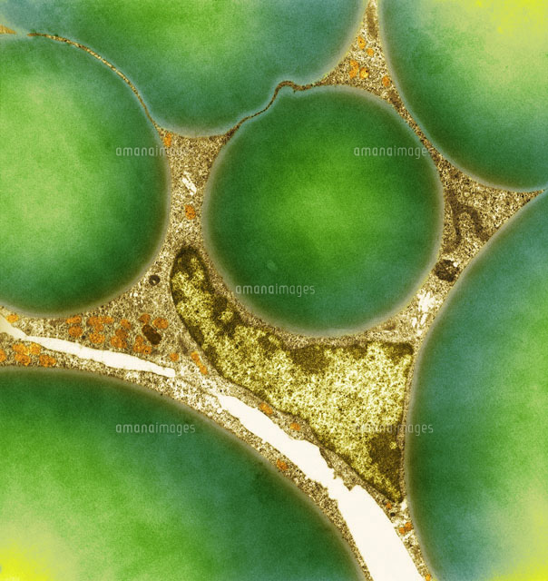 Fat cells，TEM[01809024482]の写真素材・イラスト素材｜アマナイメージズ