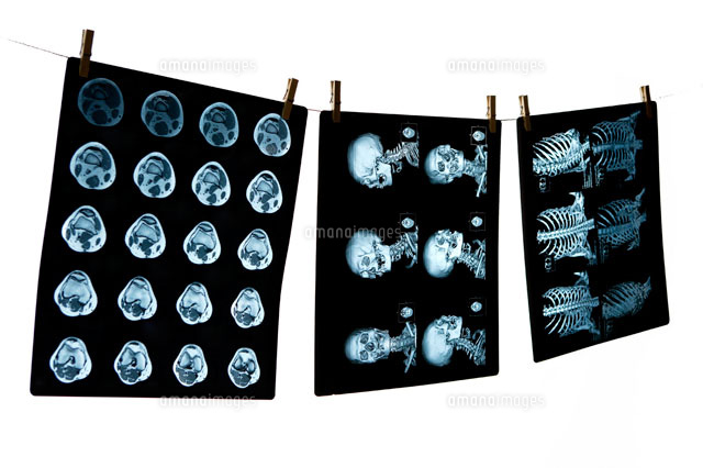 Three medical scan hanging on the rope[11010042476]の写真素材・イラスト素材｜アマナイメージズ